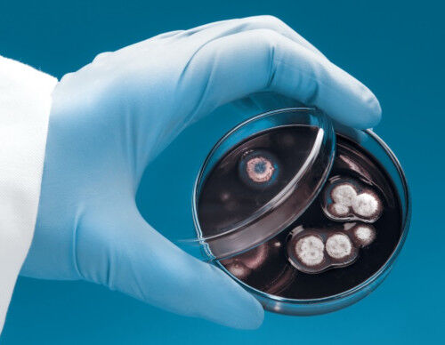Pharmacolog takes the next step towards bedside analysis of antibiotic ...